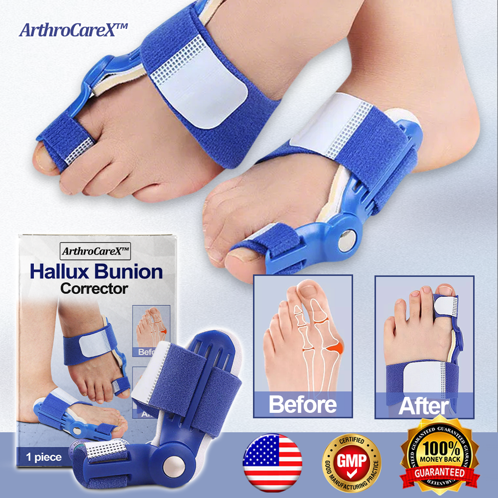 ArthroCareX™ Hallux Bunion Corrector – Comfort Corner US