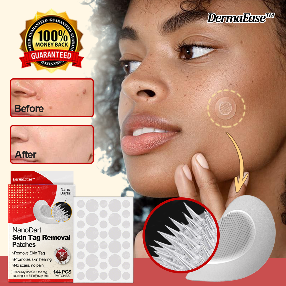 DermaEase™ NanoDart Skin Tag Removal Patches – Comfort Corner US